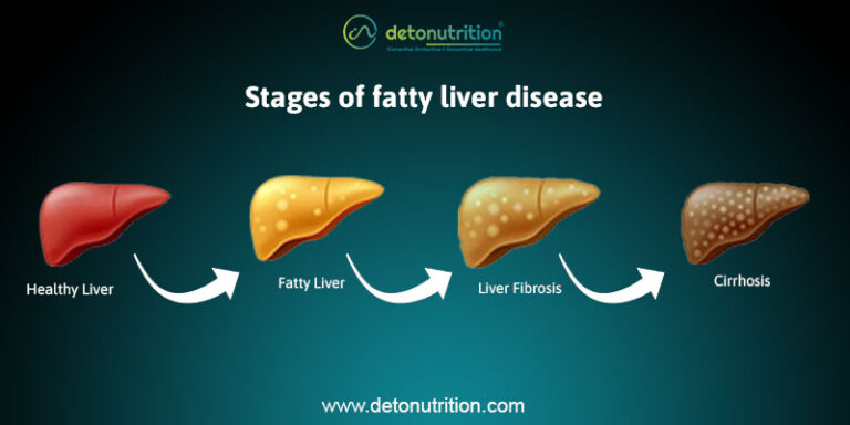 How to Fix Fatty liver Disease Types Symptoms Causes & Prevention